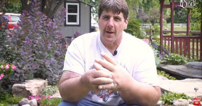 Man With The Biggest Hands In The World | Klipland.com