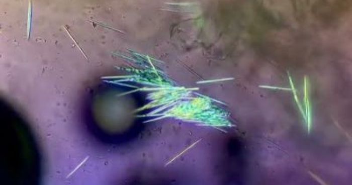 Pineapple Raphides Under Microscope | Klipland.com